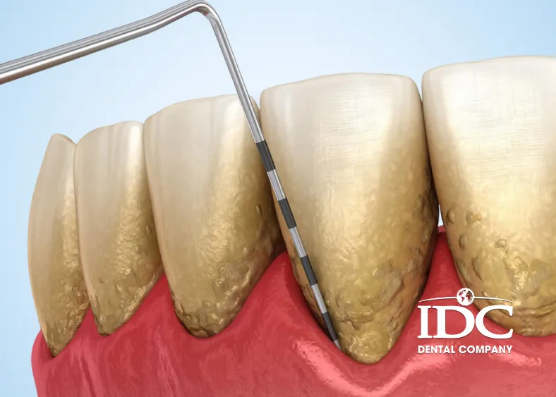 Early Signs of Periodontal Disease You Shouldn’t Ignore